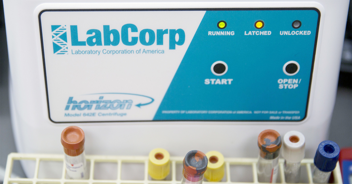 Judge allows 401(k) lawsuit against Laboratory Corp. of America to ...