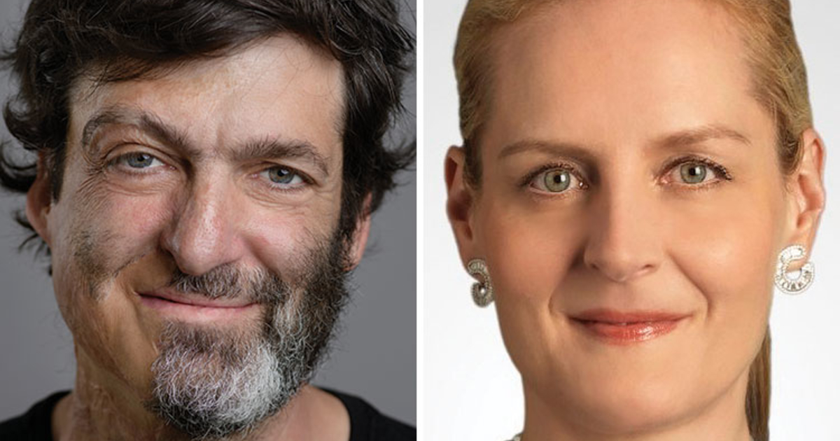 Commentary: Mind the gap — the connection between gender alignment and ...